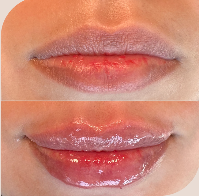 Bayan Derma